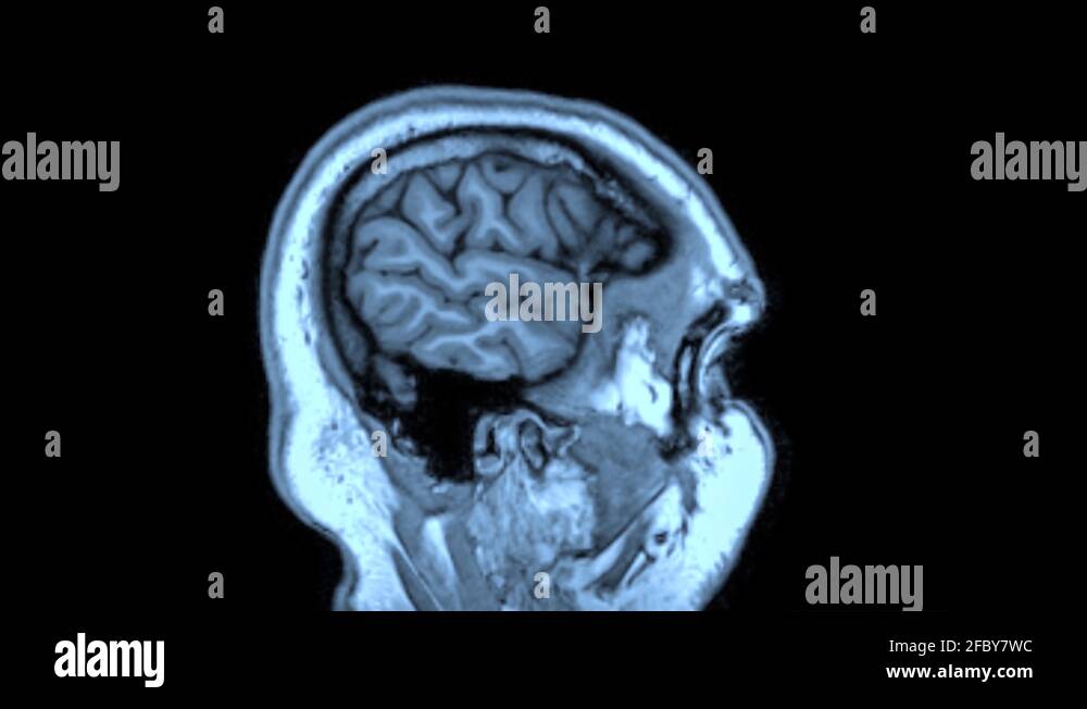 Fmri brain scan Stock Videos & Footage - HD and 4K Video Clips - Alamy