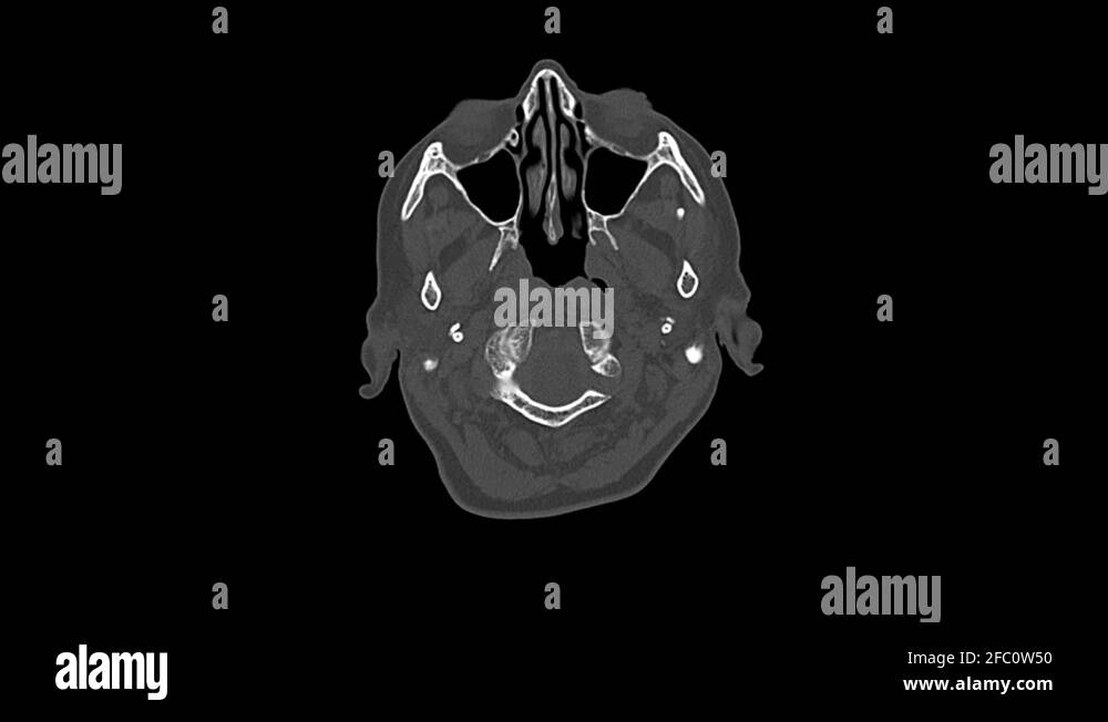 Cerebral cortex scan Stock Videos & Footage - HD and 4K Video Clips - Alamy