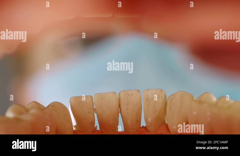 Angled teeth Stock Videos & Footage - HD and 4K Video Clips - Alamy