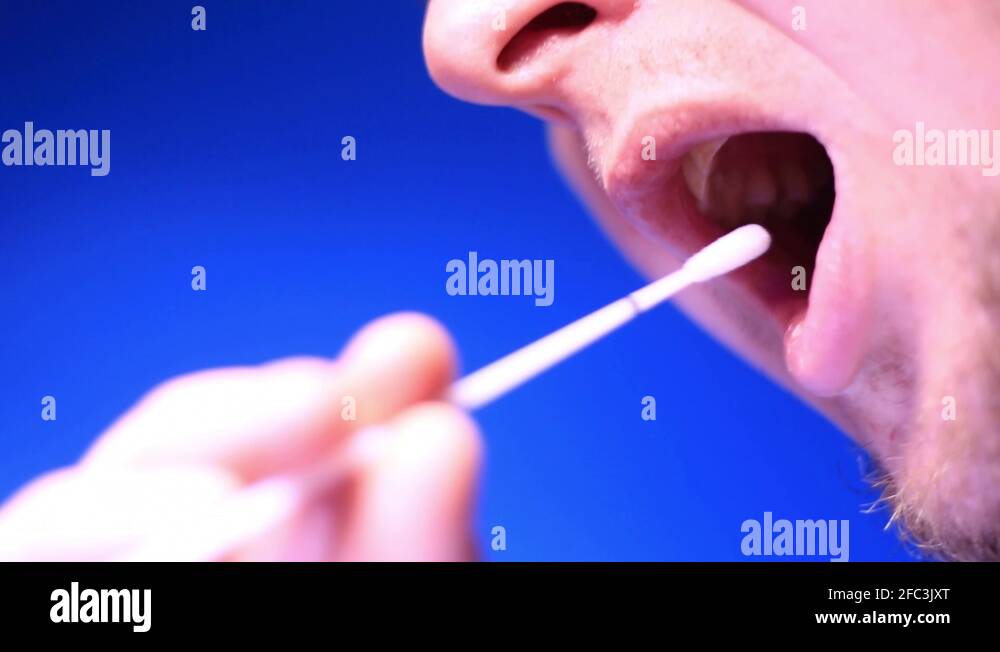Cheek swab dna Stock Videos & Footage - HD and 4K Video Clips - Alamy