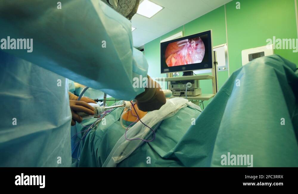 A doctor performs a surgery, using tools with camera and a monitor ...