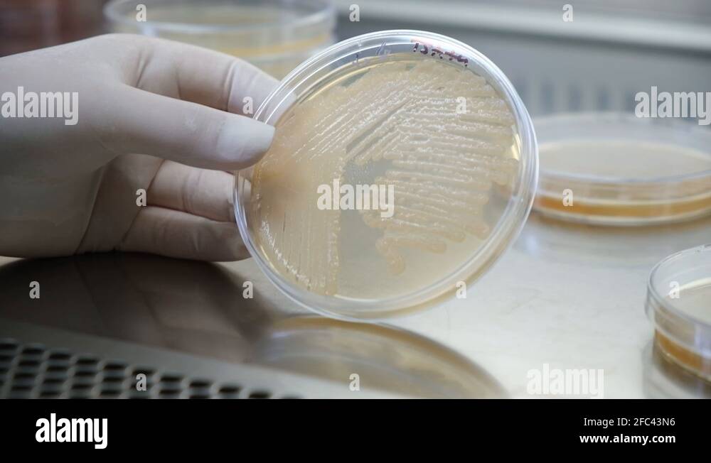 Bacteria plate Stock Videos & Footage - HD and 4K Video Clips - Alamy