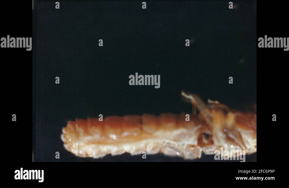 Abdomen thorax Stock Videos & Footage - HD and 4K Video Clips - Alamy