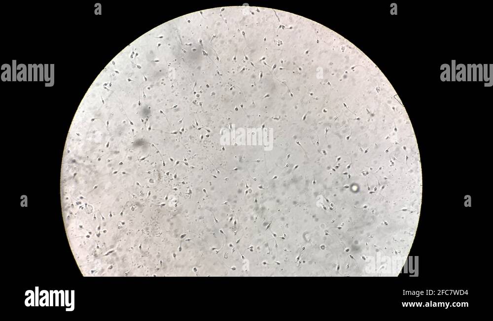Human sperm microscope Stock Videos & Footage - HD and 4K Video Clips ...