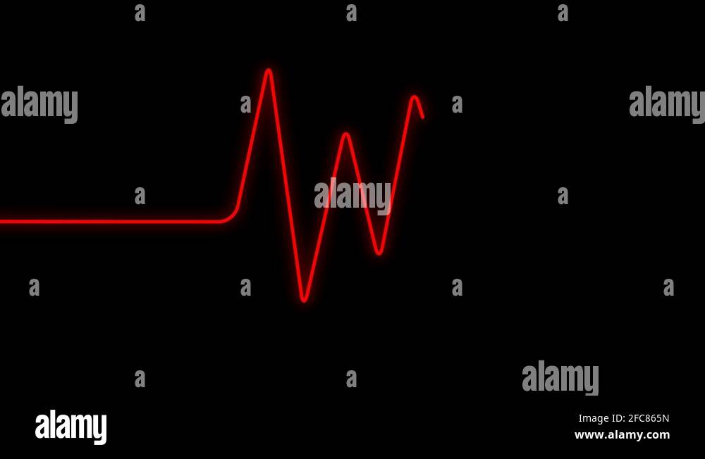 ECG also known as EKG (electrocardiogram) waveform animated on a screen ...