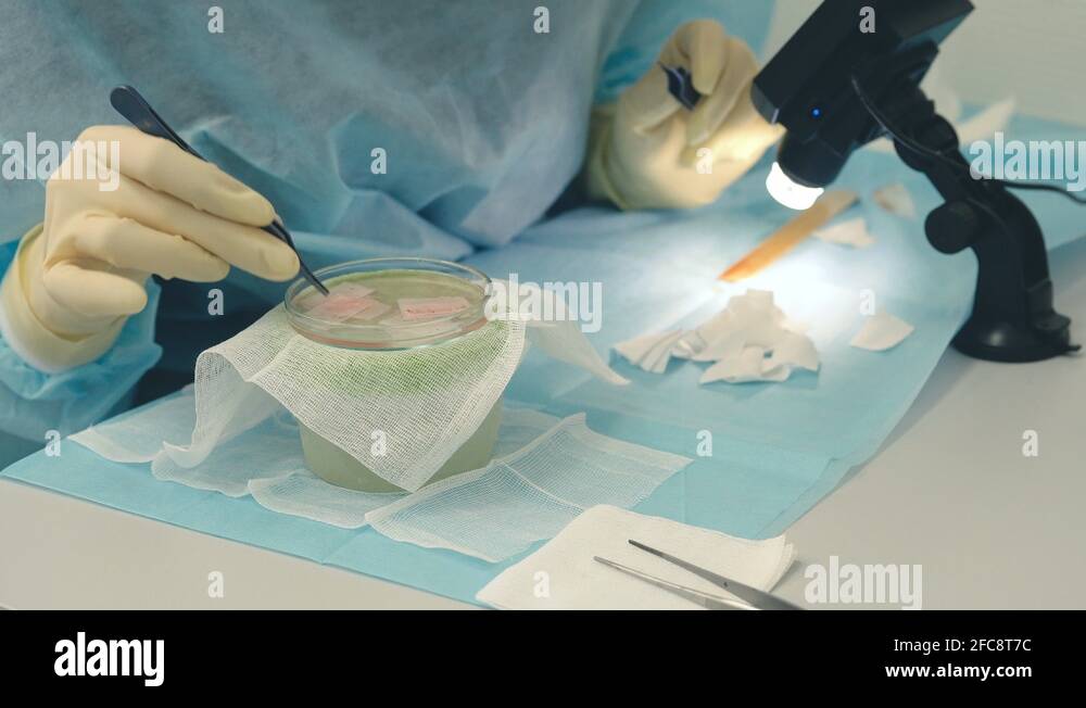 The doctor under the microscope recalculates the hair follicles ...