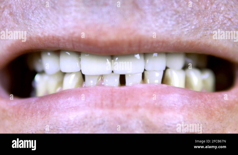 Black man gold teeth Stock Videos & Footage - HD and 4K Video Clips - Alamy