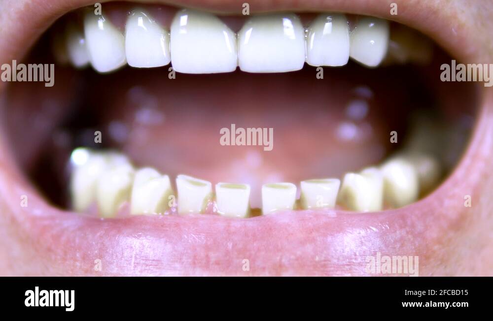 Hillbilly teeth Stock Videos & Footage - HD and 4K Video Clips - Alamy