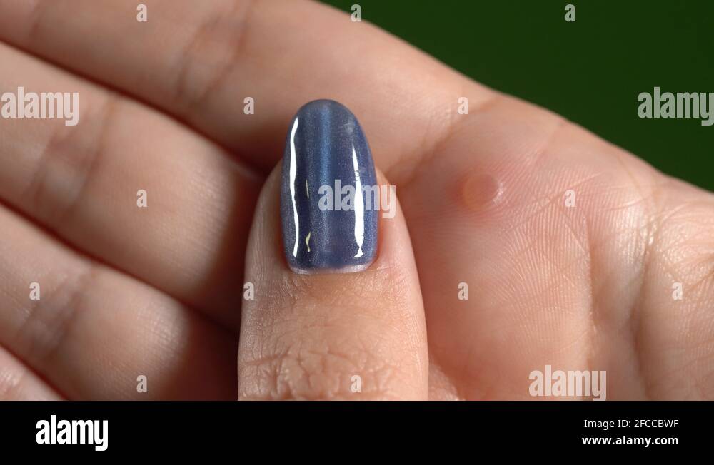 Red callus Stock Videos & Footage - HD and 4K Video Clips - Alamy