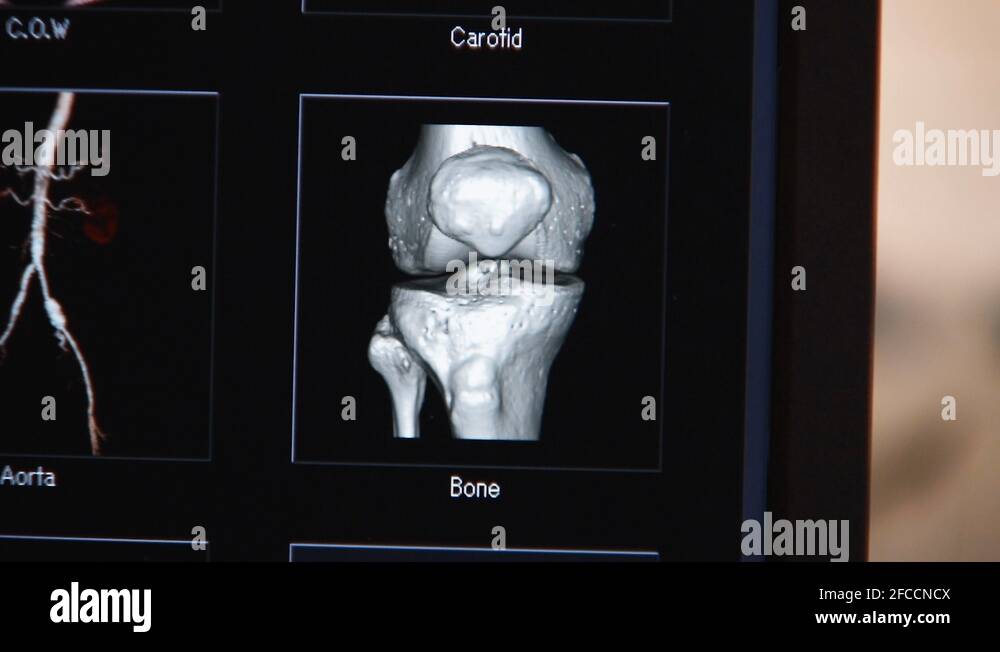 CT scanner screen menu at hospital 3D view of parts of body B Stock ...