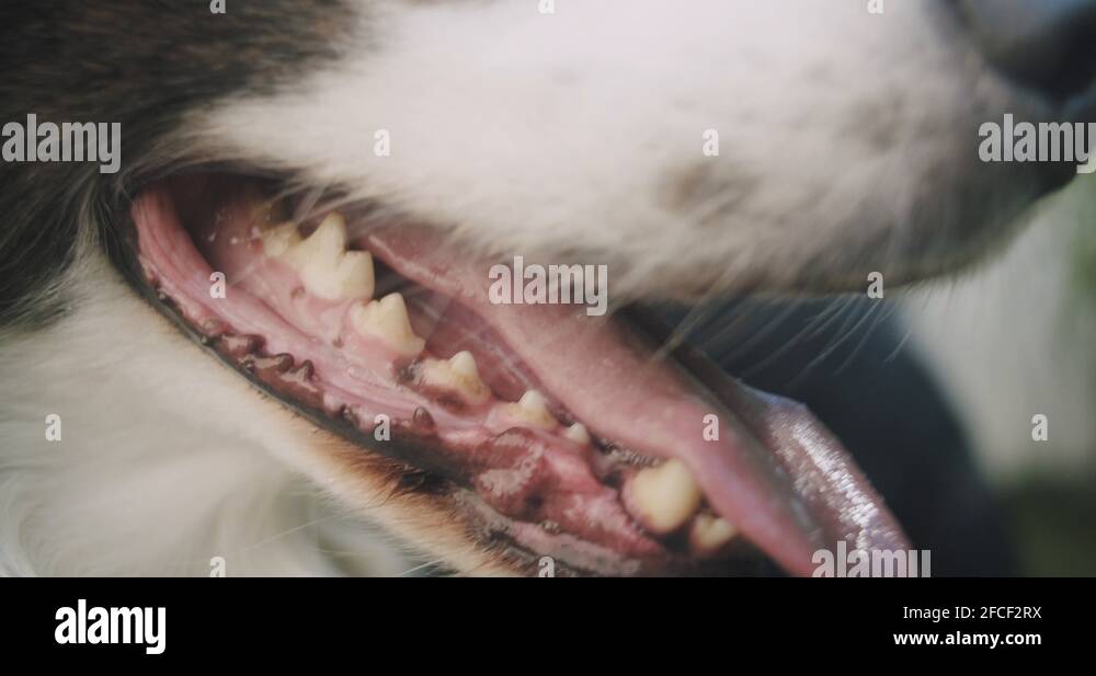 Calculus dental teeth Stock Videos & Footage - HD and 4K Video Clips ...