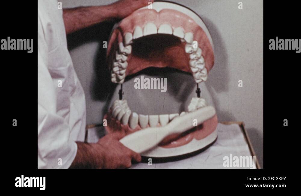 Teeth tooth mouth jaw gums Stock Videos & Footage - HD and 4K Video ...