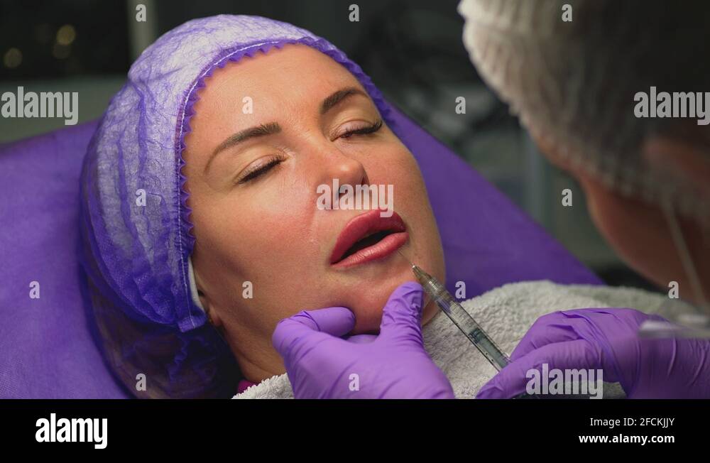 Injection plastic surgery Stock Videos & Footage - HD and 4K Video ...