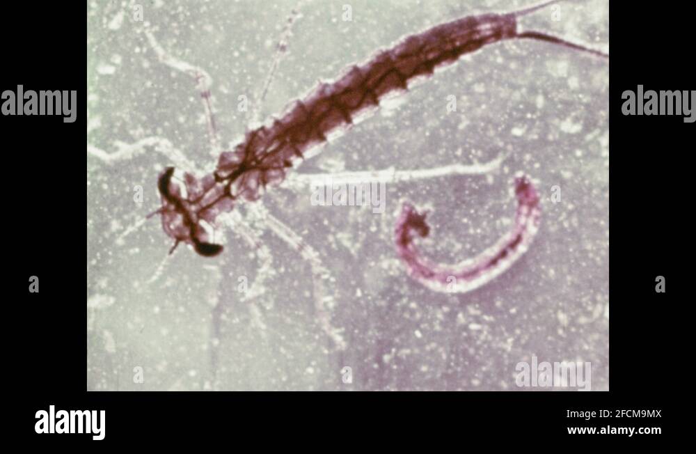 Stinging cells Stock Videos & Footage - HD and 4K Video Clips - Alamy