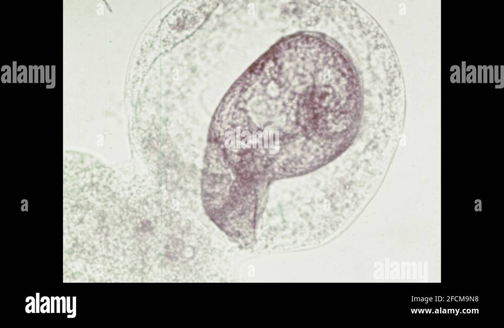 1970s: Microscopic amoeba moves. Microscopic rotifer cilia rotate Stock ...