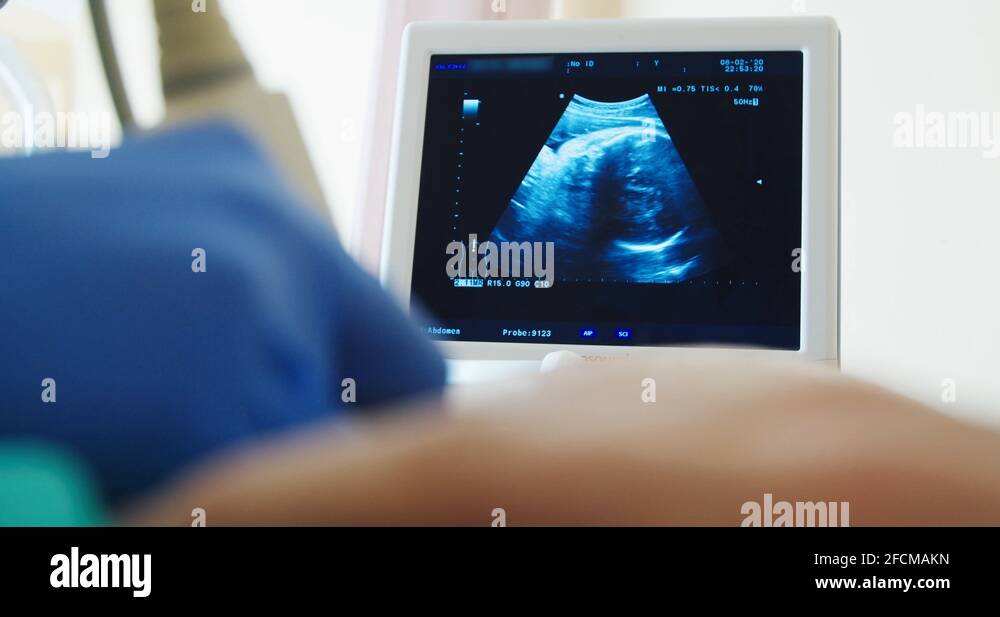 Ultrasound scan screen Stock Videos & Footage - HD and 4K Video Clips ...