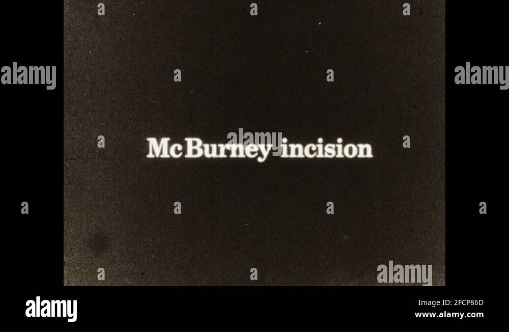 1930s: Intertitle "McBurney incision". Scalpel makes an incision ...