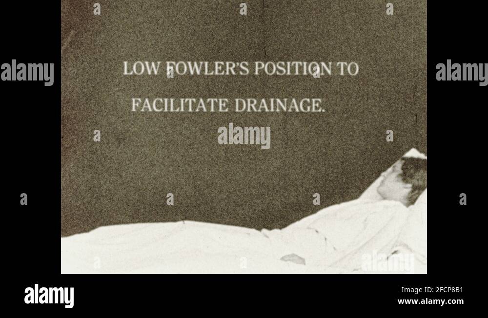 Low Fowlers Position