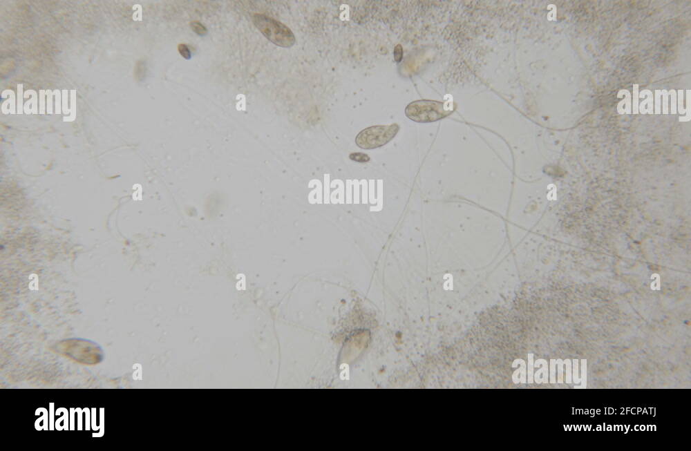 Motion of single-celled animals (infusoria) under microscope. Colony of ...