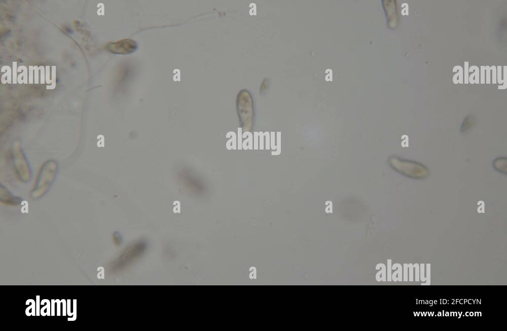 Motion of single-celled animals (infusoria) under microscope. Colony of ...