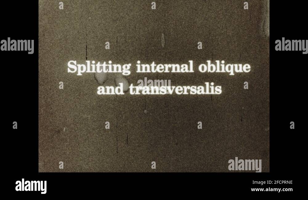 1930s: Intertitle "Splitting internal oblique and transversalis ...