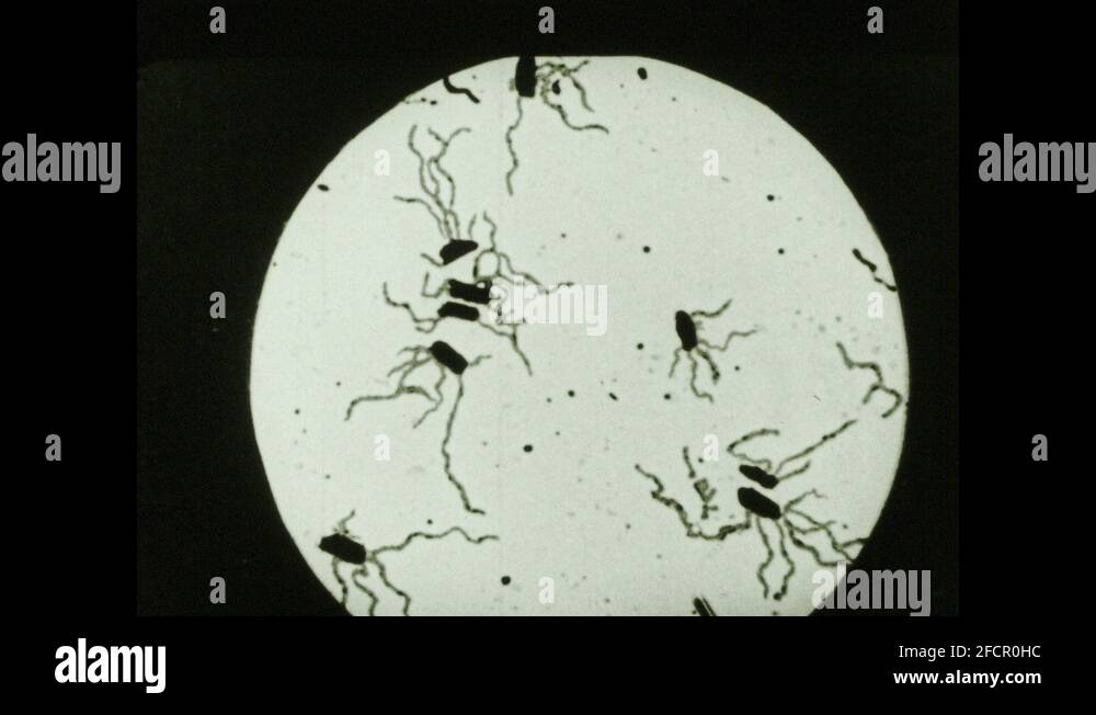 1930s: Stick points to illustration of enlarged bacillus typhosus. Text ...