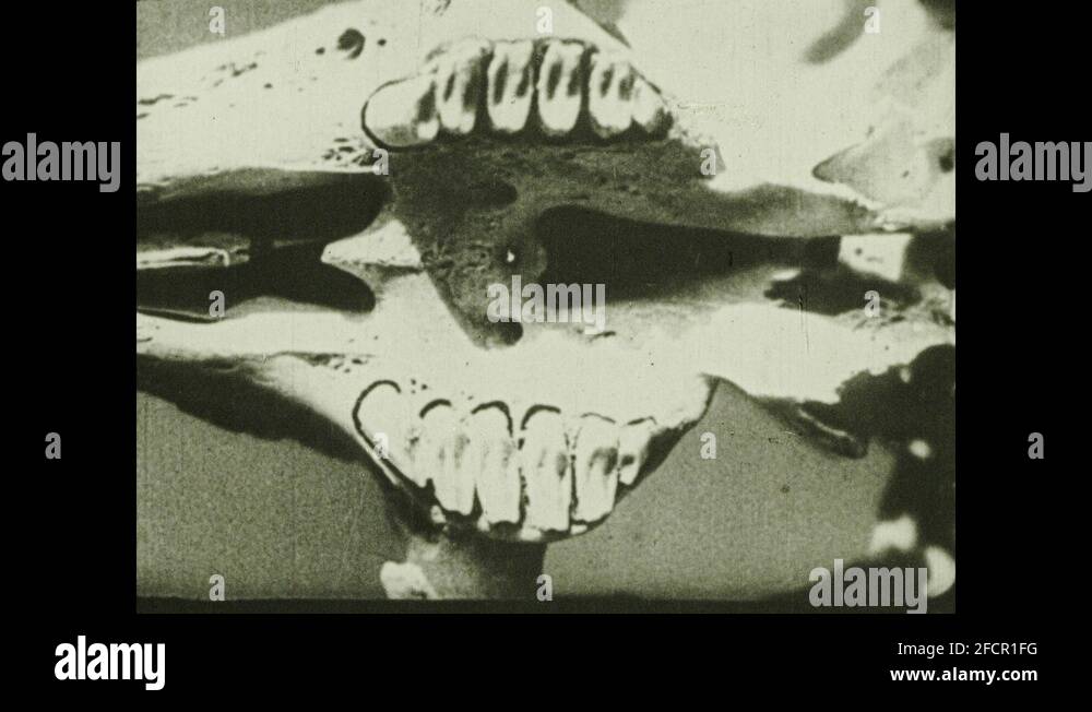 White rabbit teeth Stock Videos & Footage - HD and 4K Video Clips - Alamy