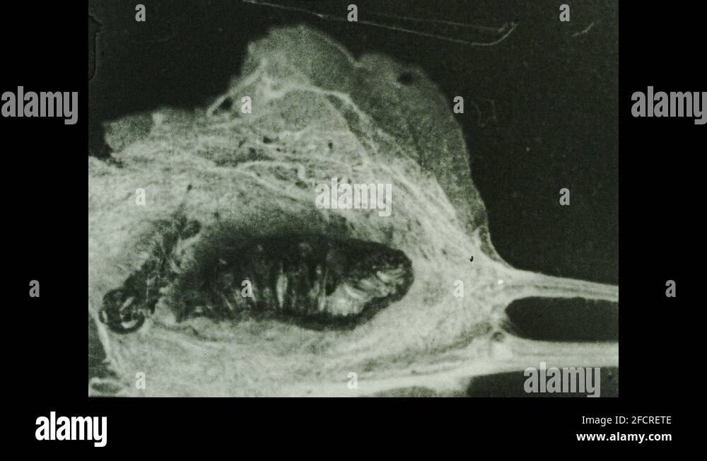 1930s: Moth pupa inside cocoon. Moth emerges from cocoon Stock Video ...