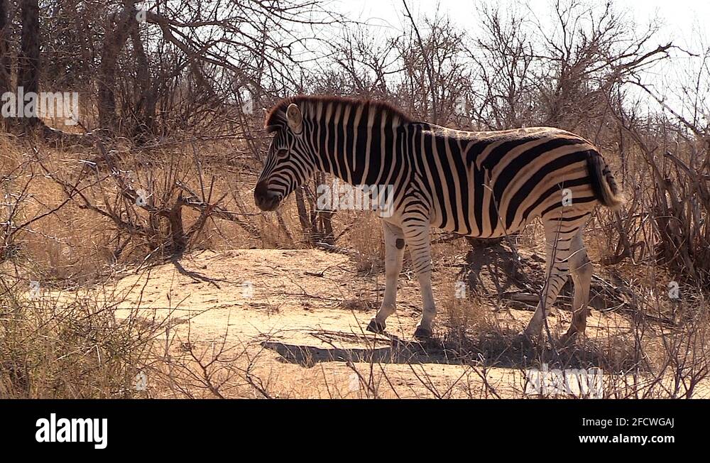Gebroken been Stock Videos & Footage - HD and 4K Video Clips - Alamy