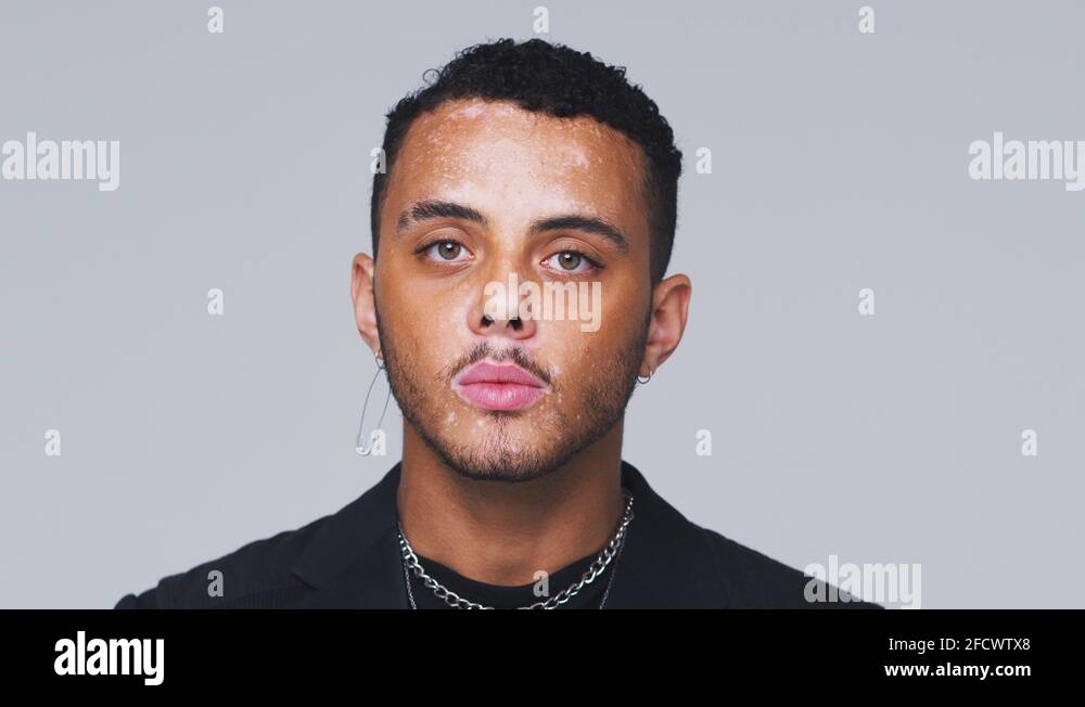 Pigmentation skin Stock Videos & Footage - HD and 4K Video Clips - Alamy