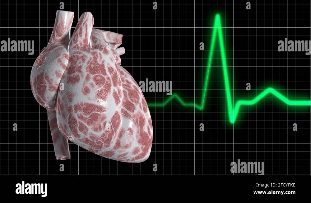 Ecg heart trace Stock Videos & Footage - HD and 4K Video Clips - Alamy