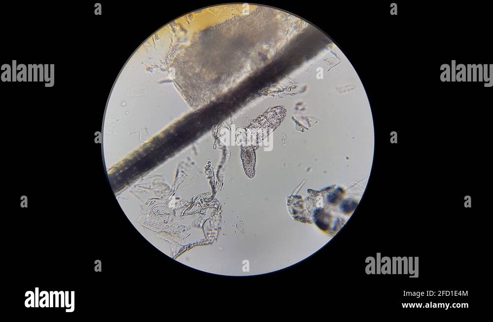 Demodex mite Stock Videos & Footage - HD and 4K Video Clips - Alamy