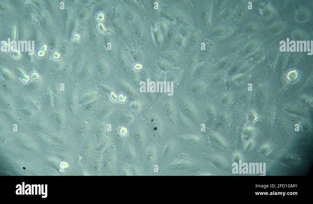 Cancer cells microscope Stock Videos & Footage - HD and 4K Video Clips ...