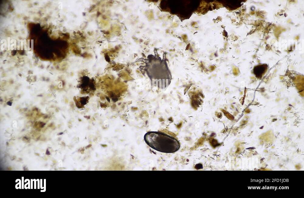 Ear microscope Stock Videos & Footage - HD and 4K Video Clips - Alamy