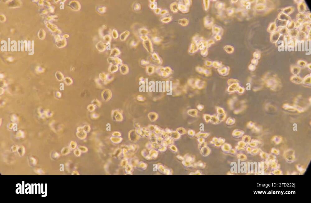Yeast cells microscope Stock Videos & Footage - HD and 4K Video Clips ...