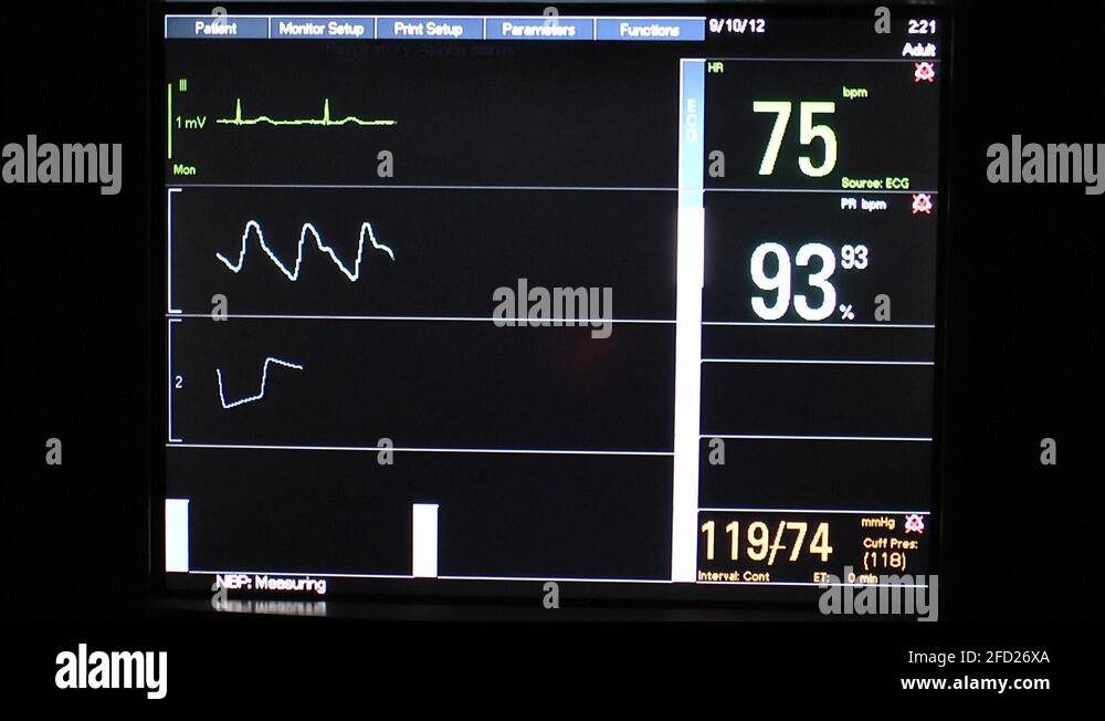 Apnea Alarm Flashes On Patient Monitor Stock Video Footage - Alamy