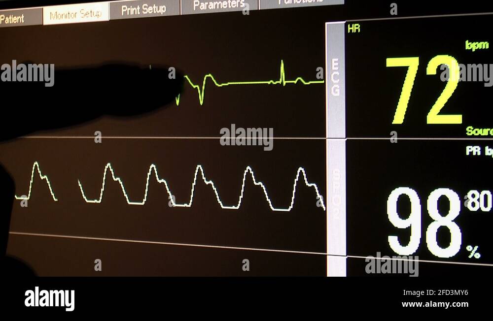 Ekg patient Stock Videos & Footage - HD and 4K Video Clips - Alamy