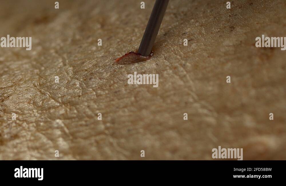 Skin close up syringe puncture Stock Videos & Footage - HD and 4K Video ...