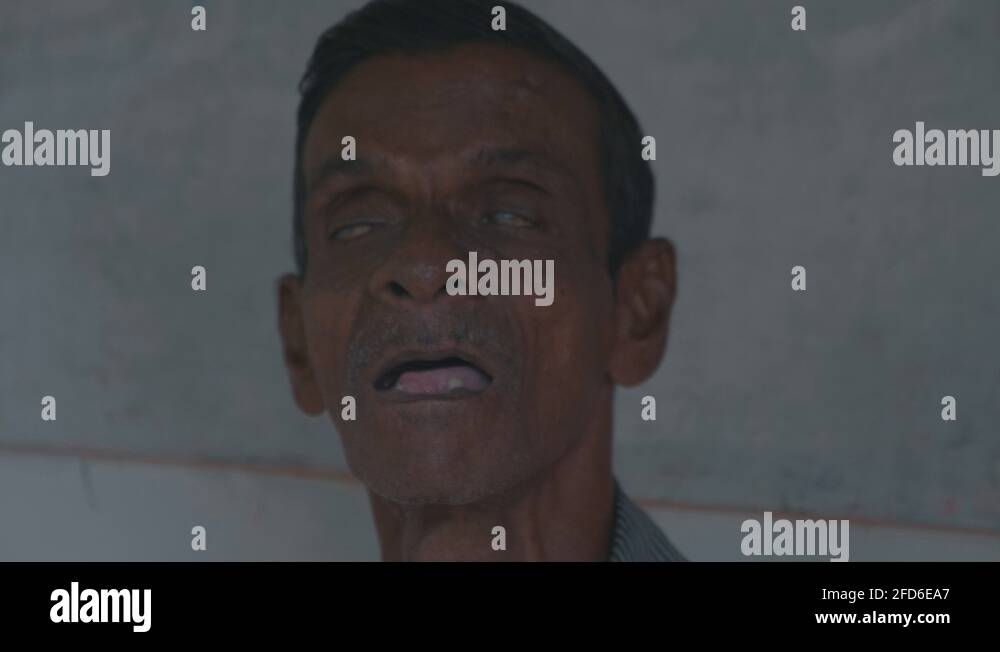 a blind and disabled old man looking straight into the camera in sri ...