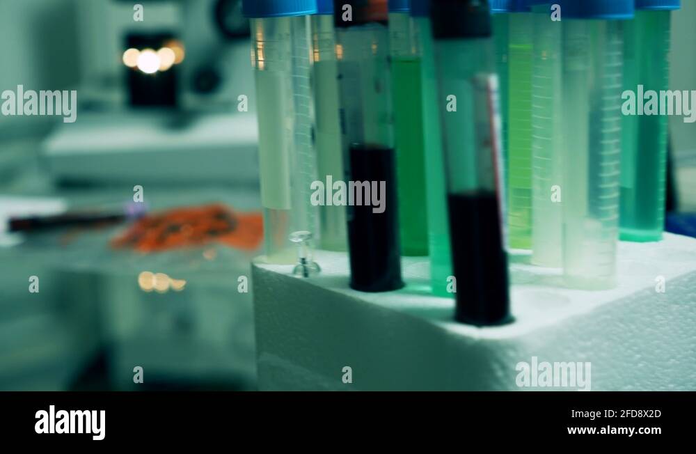 push in from test tubes to the microscope in a science laboratory Stock ...