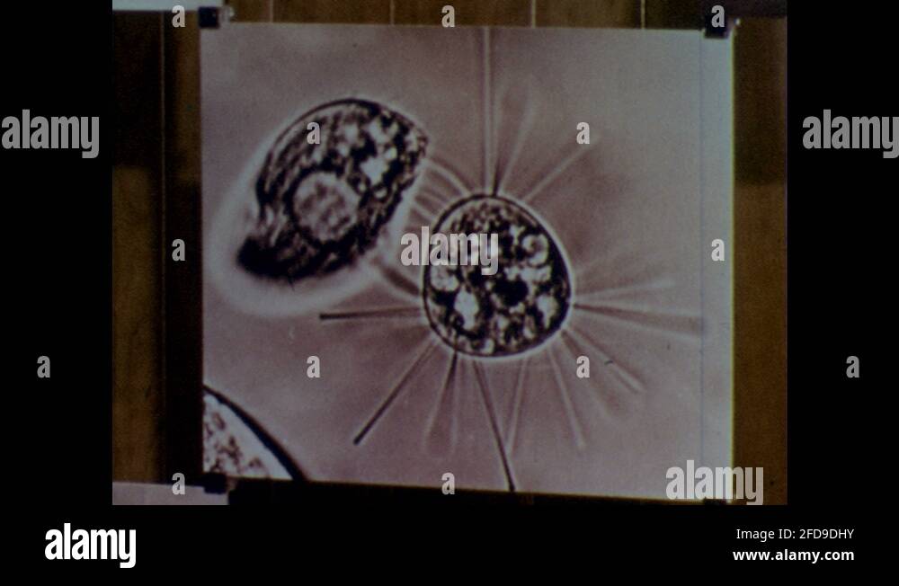 Basal disc Stock Videos & Footage - HD and 4K Video Clips - Alamy