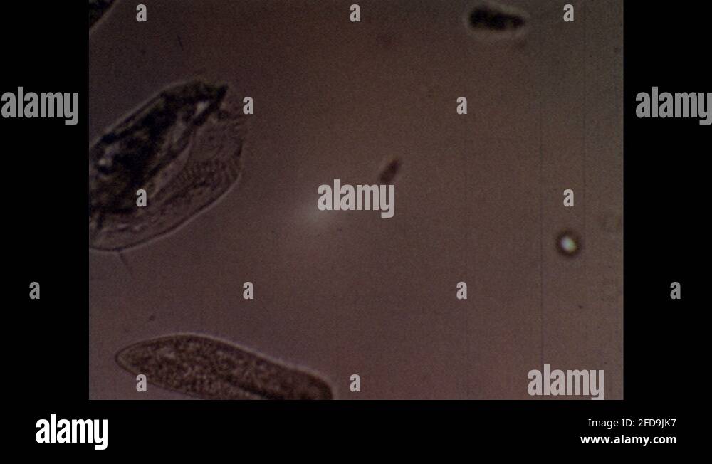 1960s: UNITED STATES: cilium under microscope. Movement of cilium. Man ...