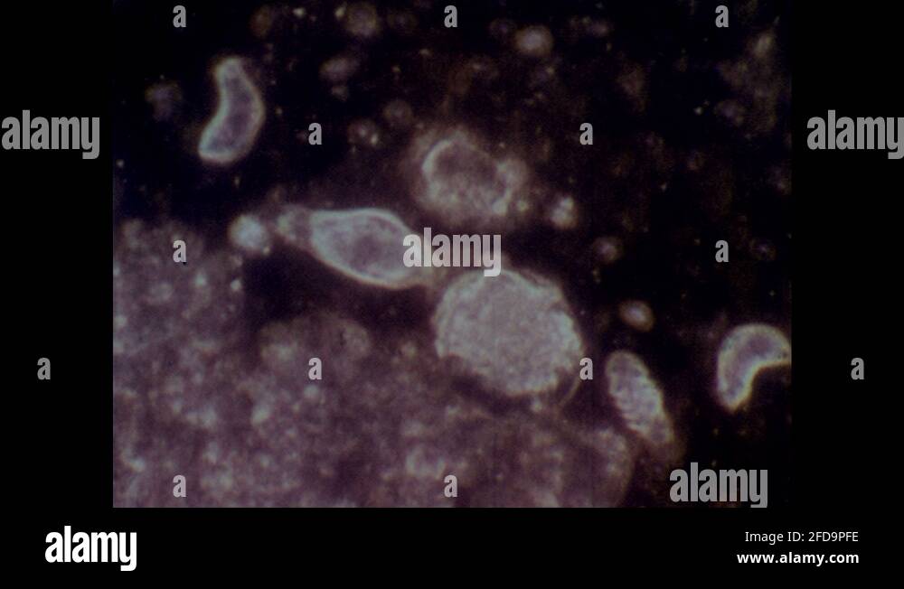 Cellulose bacteria Stock Videos & Footage - HD and 4K Video Clips - Alamy