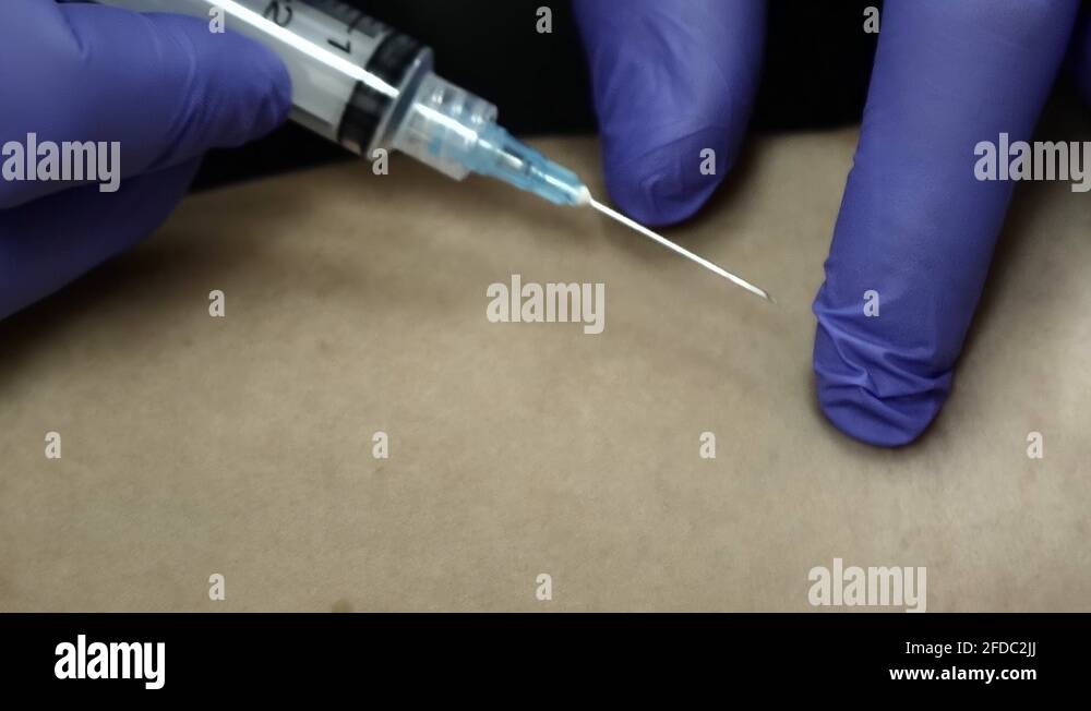 Blood extraction Stock Videos & Footage - HD and 4K Video Clips - Alamy