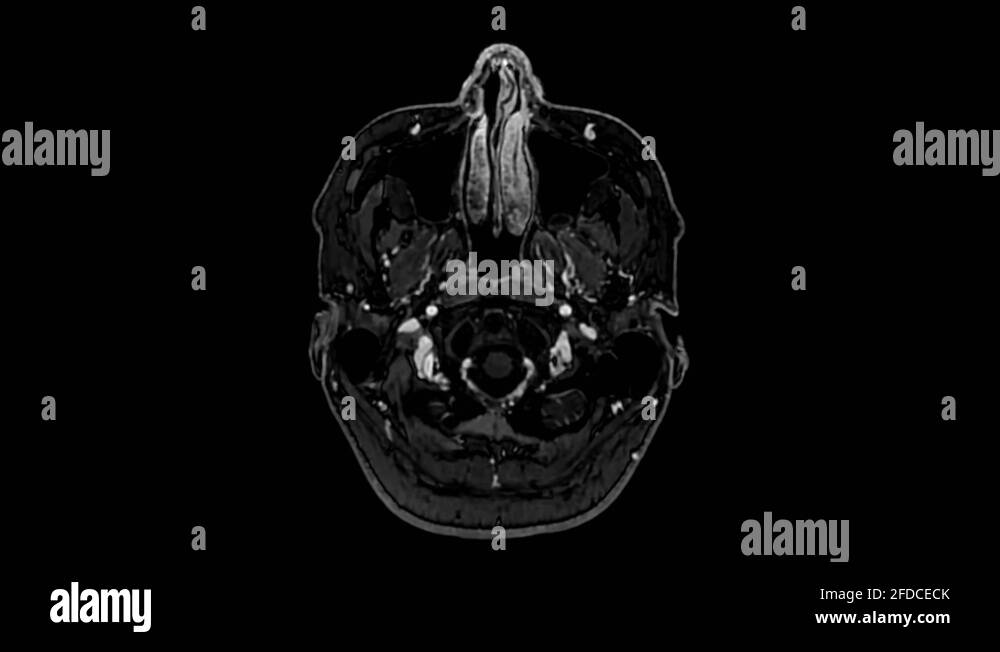 Human brain axial mri scan Stock Videos & Footage - HD and 4K Video ...
