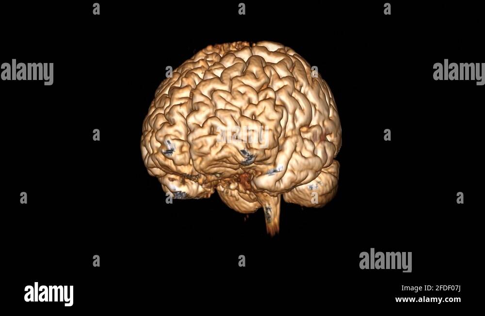 Amygdala 3d Stock Videos & Footage - HD and 4K Video Clips - Alamy