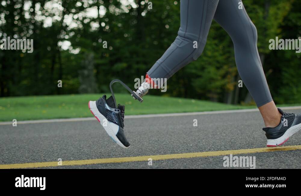 Artificial limb legs Stock Videos & Footage - HD and 4K Video Clips - Alamy
