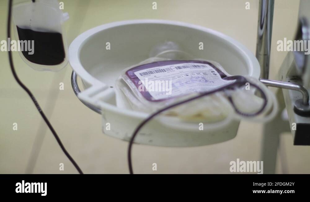 Blood donation. Blood transfusion. Bags and tubes full with human blood ...