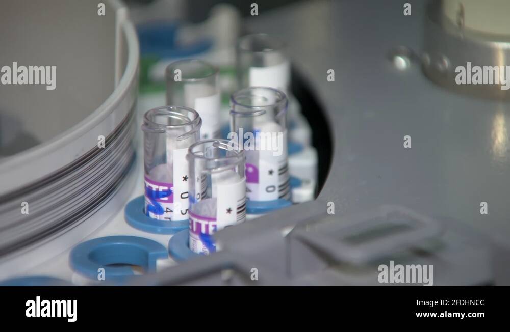 Biochemical tests bacteria Stock Videos & Footage - HD and 4K Video ...