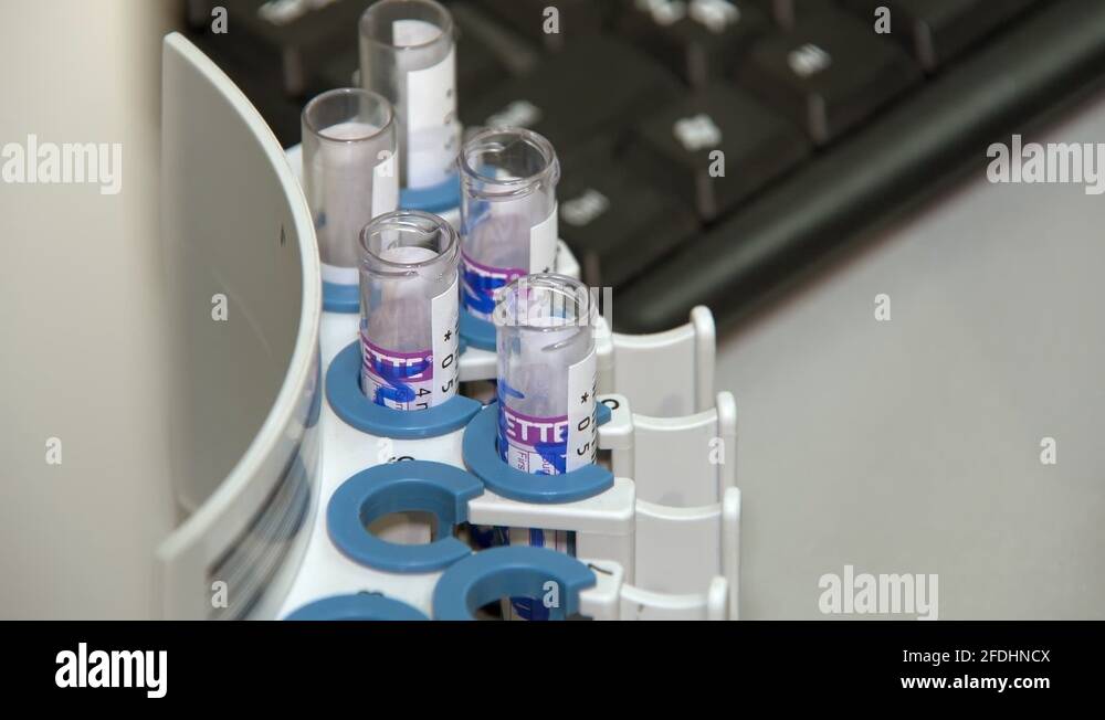 Laboratory test vials Stock Videos & Footage - HD and 4K Video Clips ...